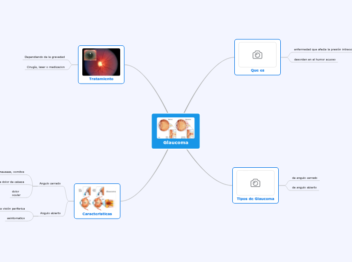 Glaucoma - Mind Map